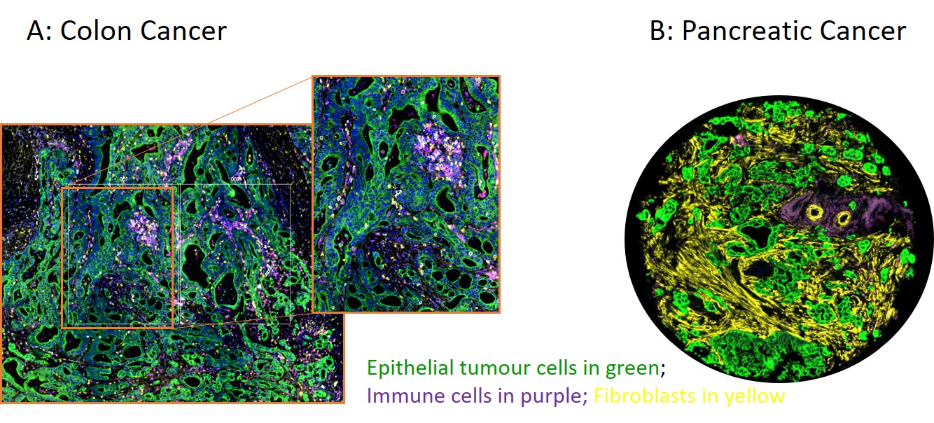 Cancer | National Mouse Genetics Network