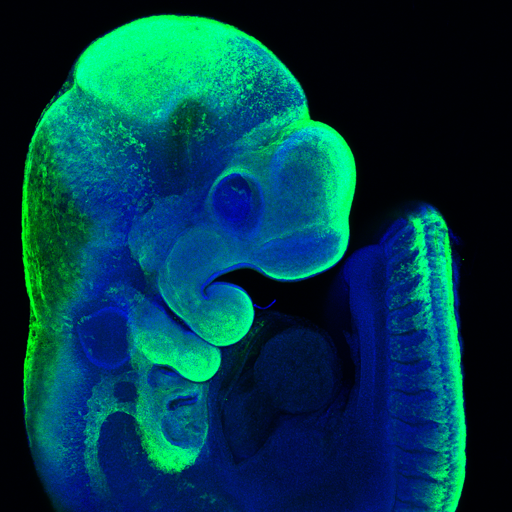 Congenital Anomalies | National Mouse Genetics Network